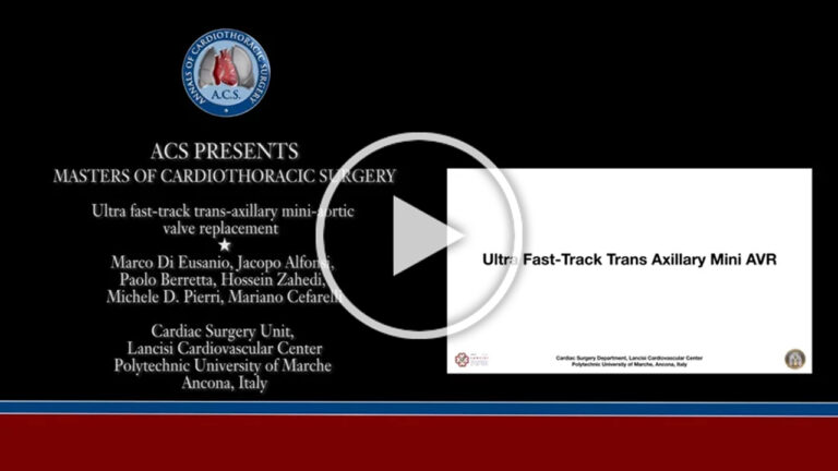 Video gallery – Minicardiac Surgery Ancona