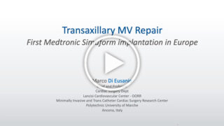 Video gallery – Minicardiac Surgery Ancona