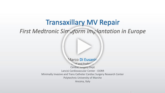 Video gallery – Minicardiac Surgery Ancona