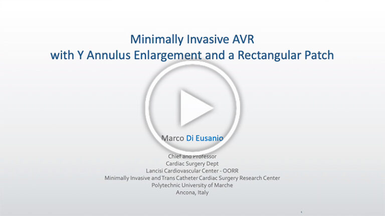 Video gallery – Minicardiac Surgery Ancona