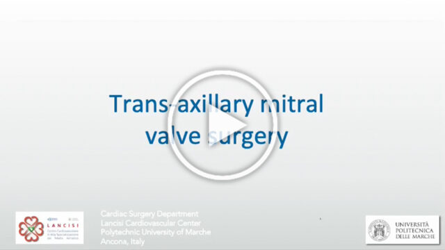 Video gallery – Minicardiac Surgery Ancona