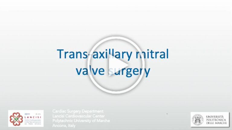 Video gallery – Minicardiac Surgery Ancona