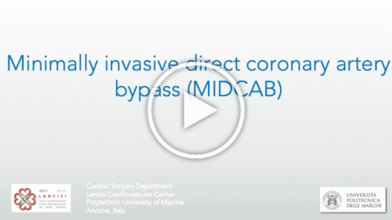 Video gallery – Minicardiac Surgery Ancona